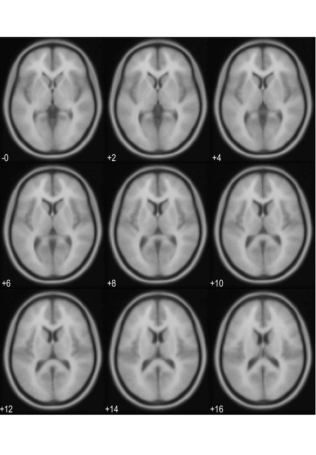 How to change slices in the sliceOverlay spm figure · Issue #469 · cpp ...