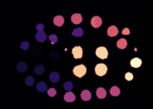 b_box implementation · Issue #93 · bowang-lab/MedSAM · GitHub