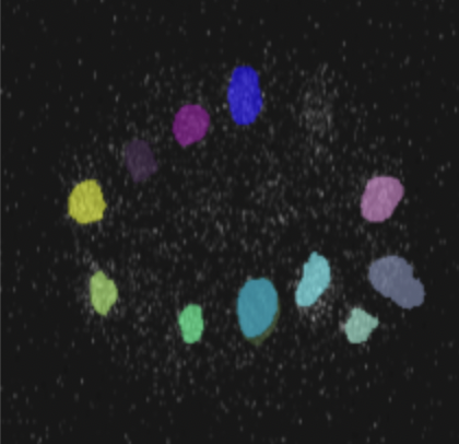 CellSAM: Fine-Tuning Segment Anything Model on C. elegans Cell Images GSoC 2023 · GitHub