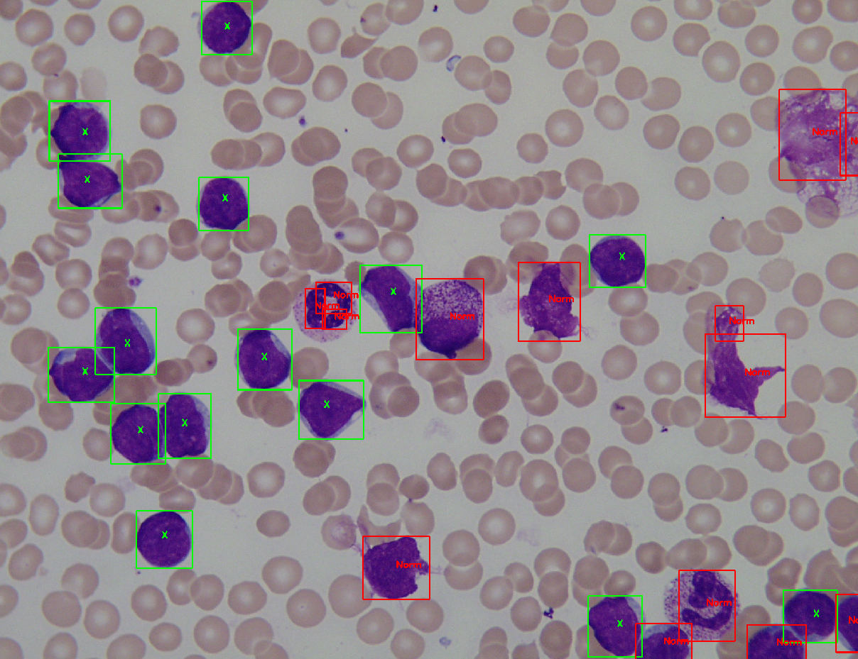 Github Hcyja1 Leukemia Detection And Classification Detection And