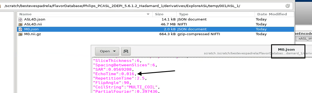Philips HAD4 and HAD8 import · Issue #1059 · ExploreASL/ExploreASL · GitHub