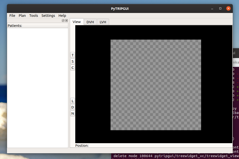 No need to display DVH, LVH and View tabs when app is started · Issue #277 · pytrip/pytripgui ...