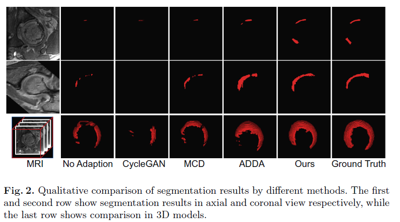Entropy Guided Unsupervised Domain Adaptation for Cross-Center Hip Cartilage Segmentation from ...