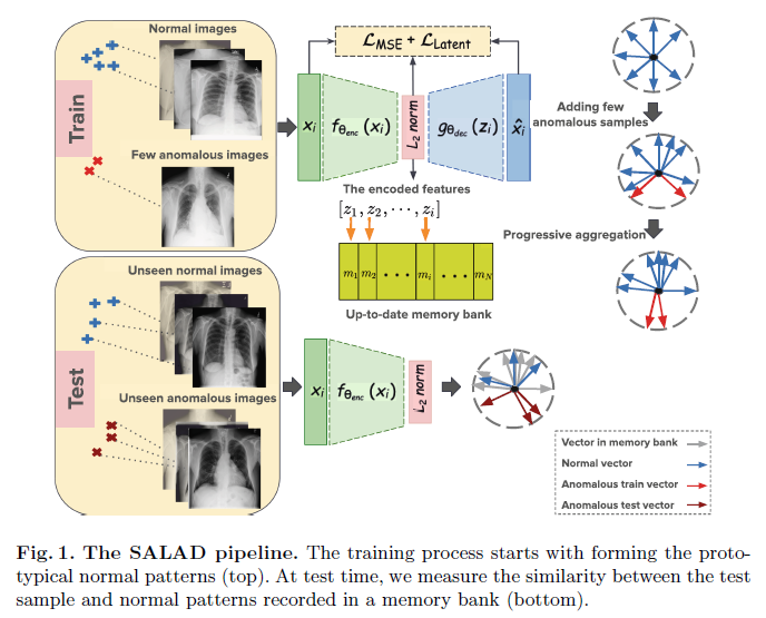 SALAD: Self-supervised Aggregation Learning for Anomaly Detection on X ...