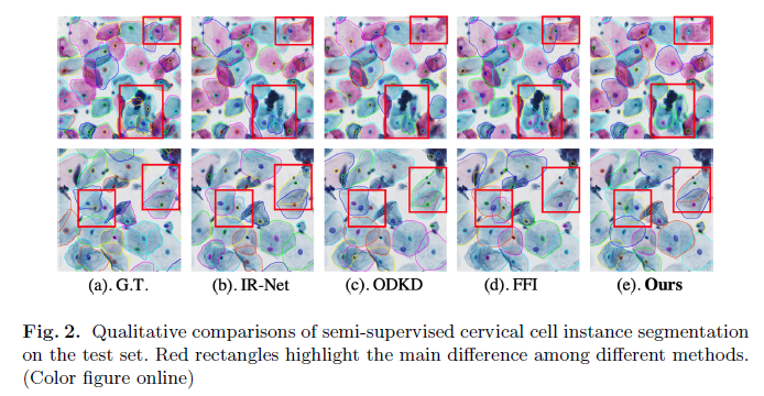 Deep Semi-supervised Knowledge Distillation for Overlapping Cervical ...