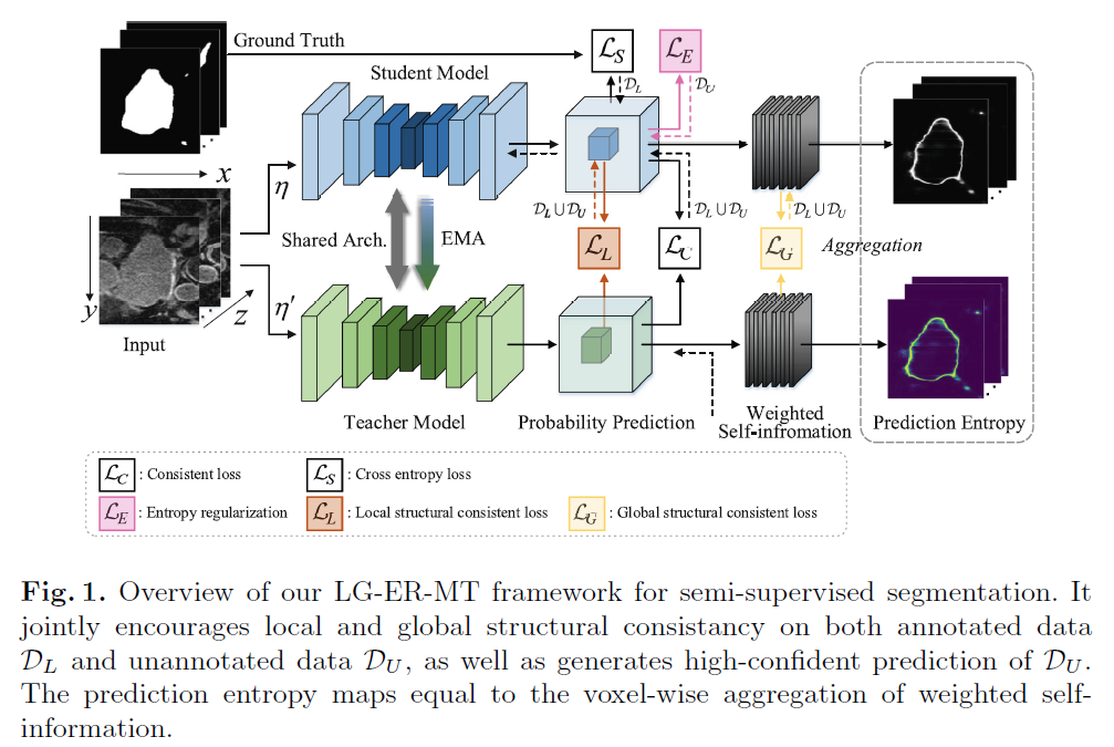 Local and Global Structure-Aware Entropy Regularized Mean Teacher Model for 3D Left Atrium ...