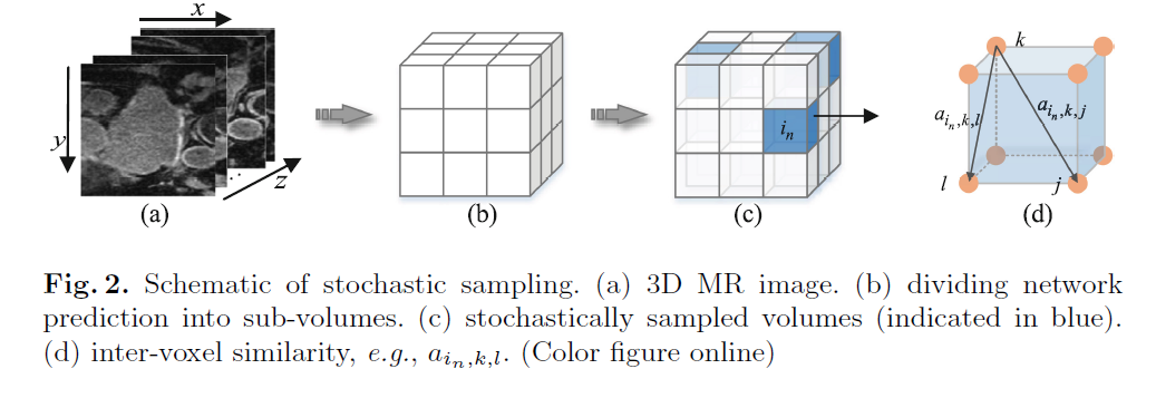 Local and Global Structure-Aware Entropy Regularized Mean Teacher Model for 3D Left Atrium ...