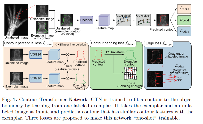 Learning to Segment Anatomical Structures Accurately from One Exemplar · Issue #90 · 3D-ICE ...