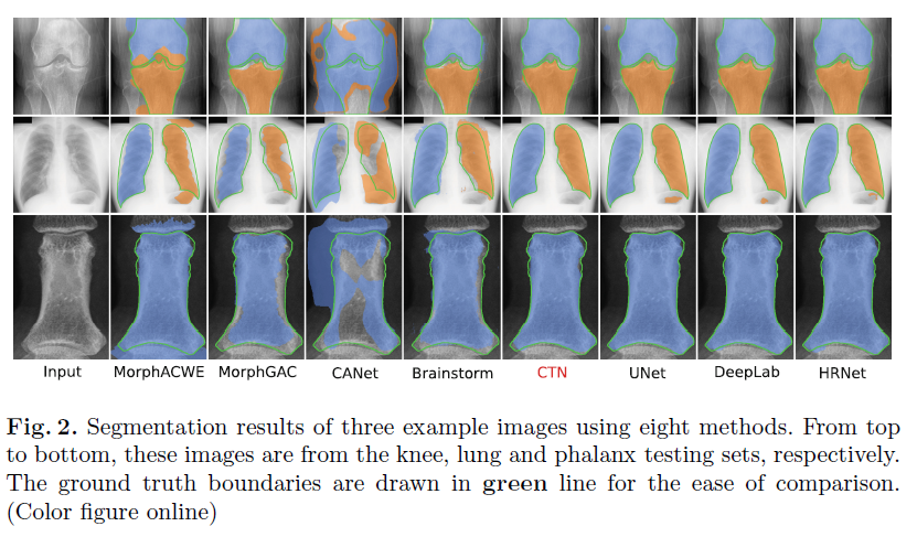 Learning to Segment Anatomical Structures Accurately from One Exemplar ...