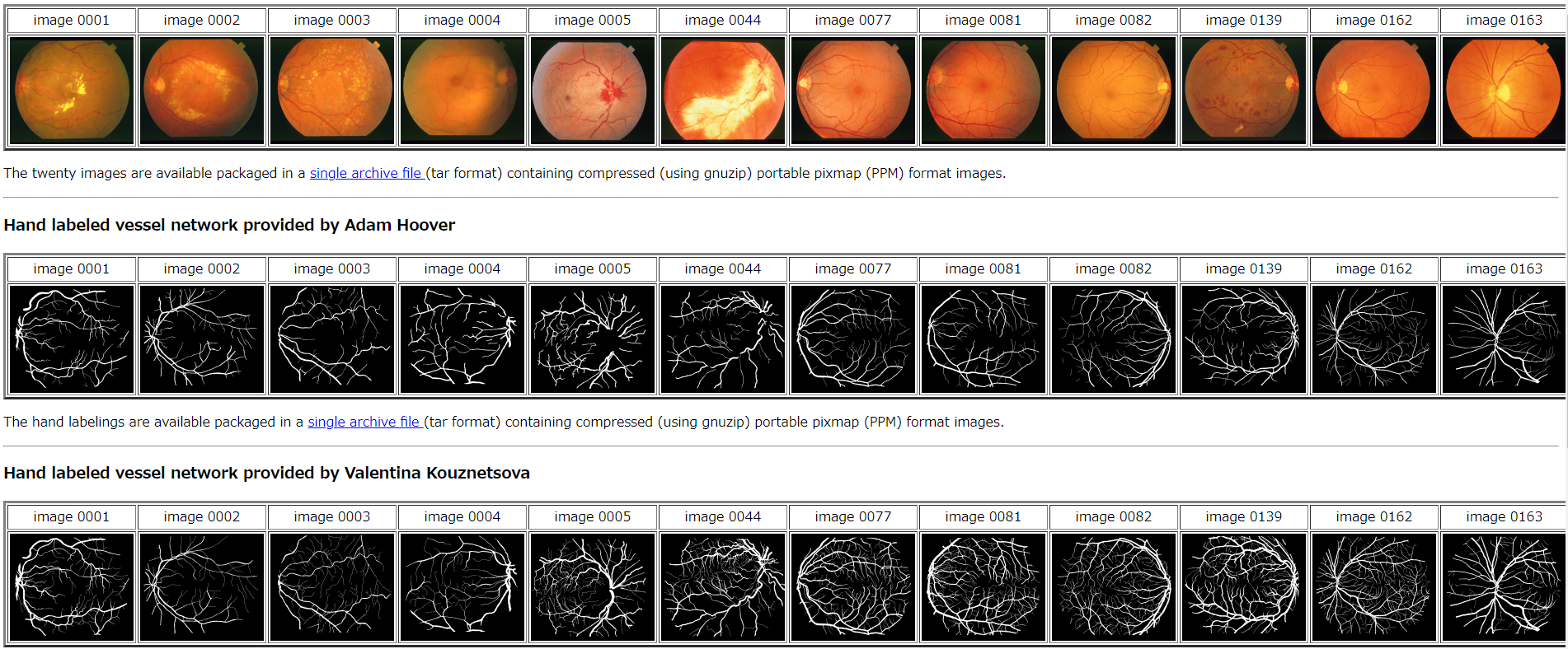 STARE Dataset · Issue #177 · 3D-ICE-arXiv/Papers · GitHub
