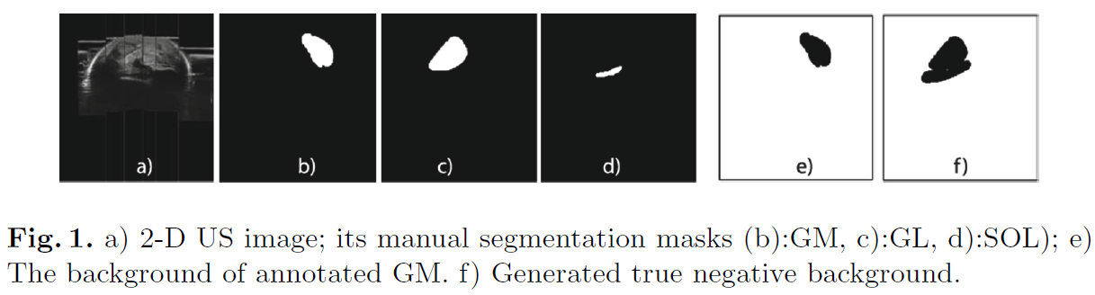 Spatio-Temporal Consistency and Negative Label Transfer for 3D Freehand US Segmentation · Issue ...