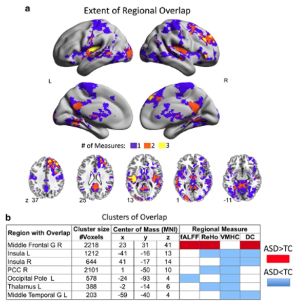 Autism Brain Imaging Data Exchange dataset (ABIDE) · Issue #183 · 3D ...
