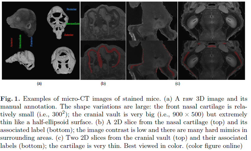 Cartilage Segmentation in High-Resolution 3D Micro-CT Images via Uncertainty-Guided Self ...