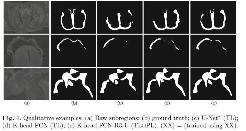 Cartilage Segmentation in High-Resolution 3D Micro-CT Images via Uncertainty-Guided Self ...