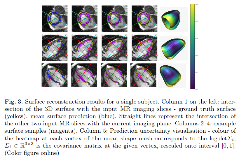 Probabilistic 3D Surface Reconstruction from Sparse MRI Information · Issue #103 · 3D-ICE-arXiv ...