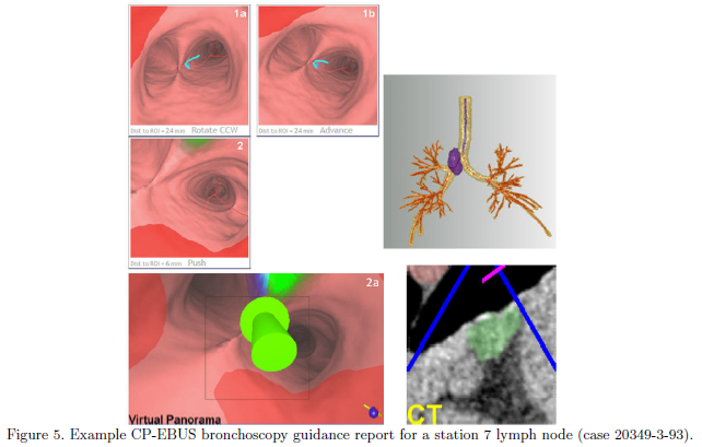 Autonomous planning and guidance for convex-probe endobronchial ...