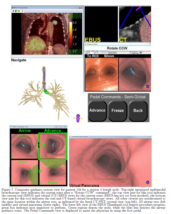 Autonomous planning and guidance for convex-probe endobronchial ultrasound bronchoscopy · Issue ...