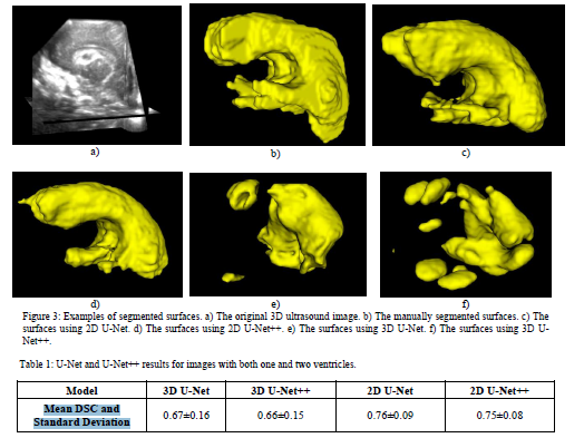Automatic deep learning-based segmentation of neonatal cerebral ventricles from 3D ultrasound ...