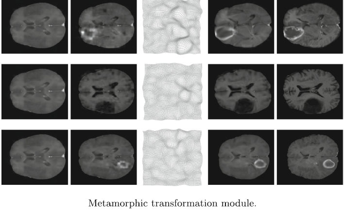 Learning Joint Shape and Appearance Representations with Metamorphic ...