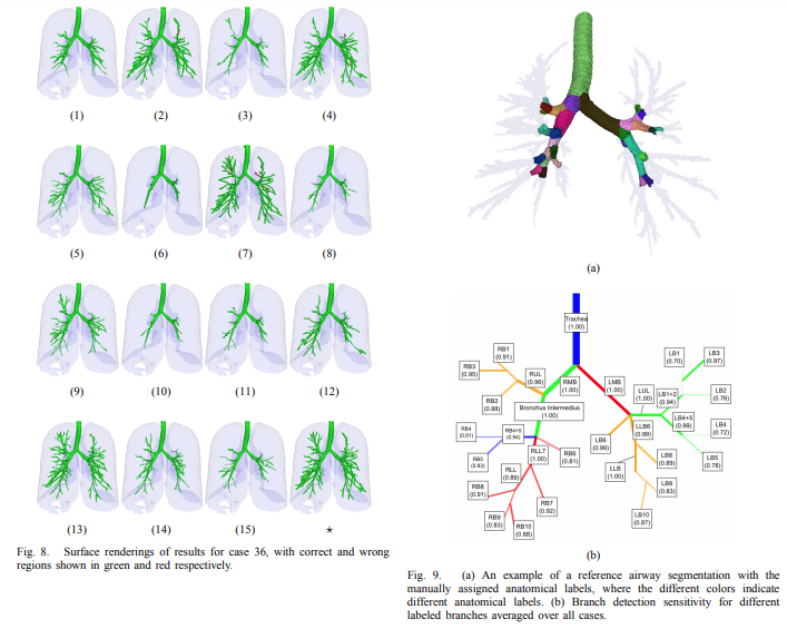 Extraction of Airways From CT (EXACT'09) · Issue #27 · 3D-ICE-arXiv/Papers · GitHub