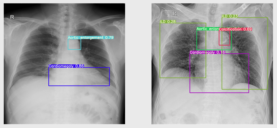GitHub - X-Ray-Project/main: To manage code.