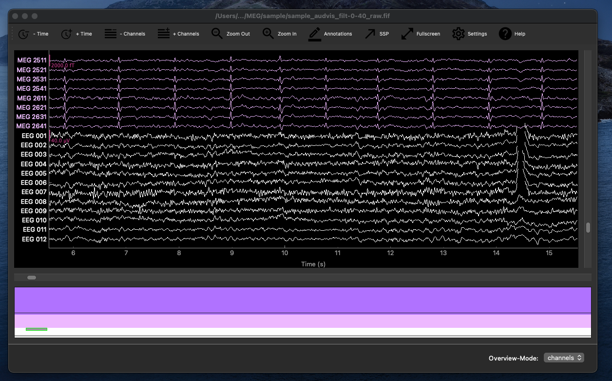 Improve dark mode · Issue #83 · mne-tools/mne-qt-browser · GitHub