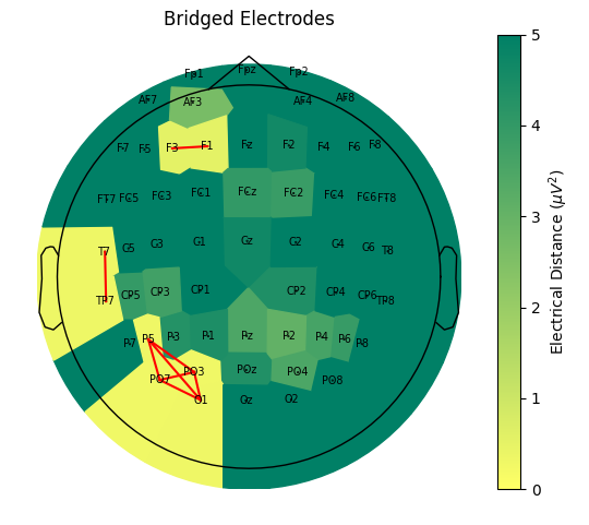 Interpolate bridge electrodes when more than 2 electrodes are bridged ...
