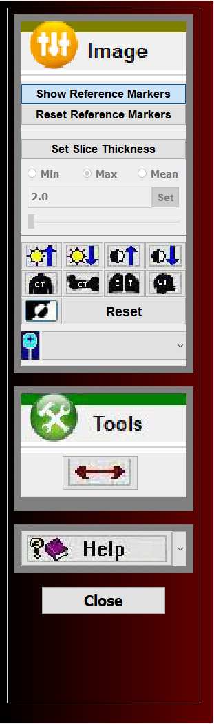 (Priority 2) QREADS Toolbar enhancements · Issue #40 · KitwareMedical ...