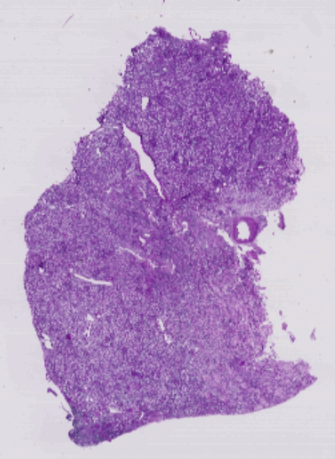 GitHub - victoria-lokteva/Kidney-segmentation