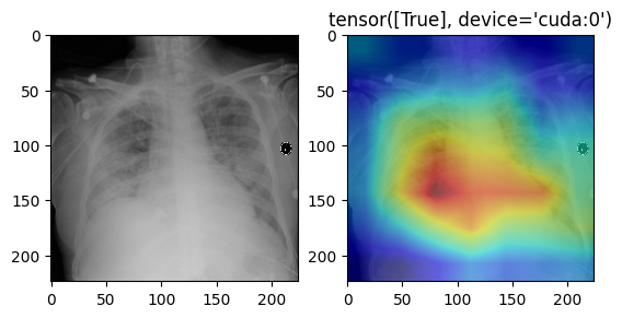 GitHub - parham2013/Pneumonia-Classification-PyTorch