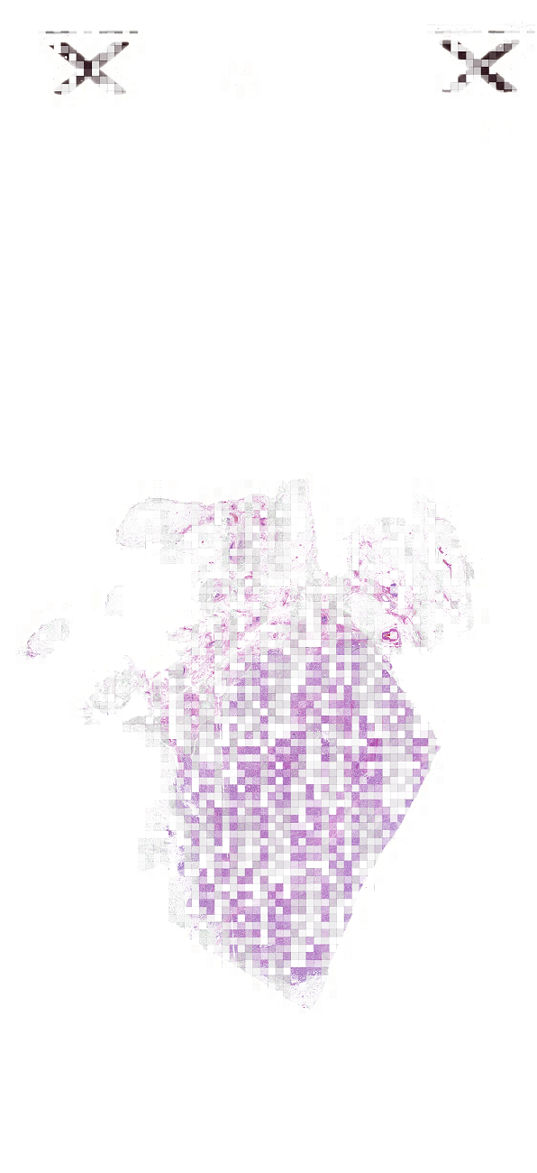 OpenSlide Error with Pixman Version 0.38 (Ubuntu 20.x) · Issue #133 · TissueImageAnalytics ...
