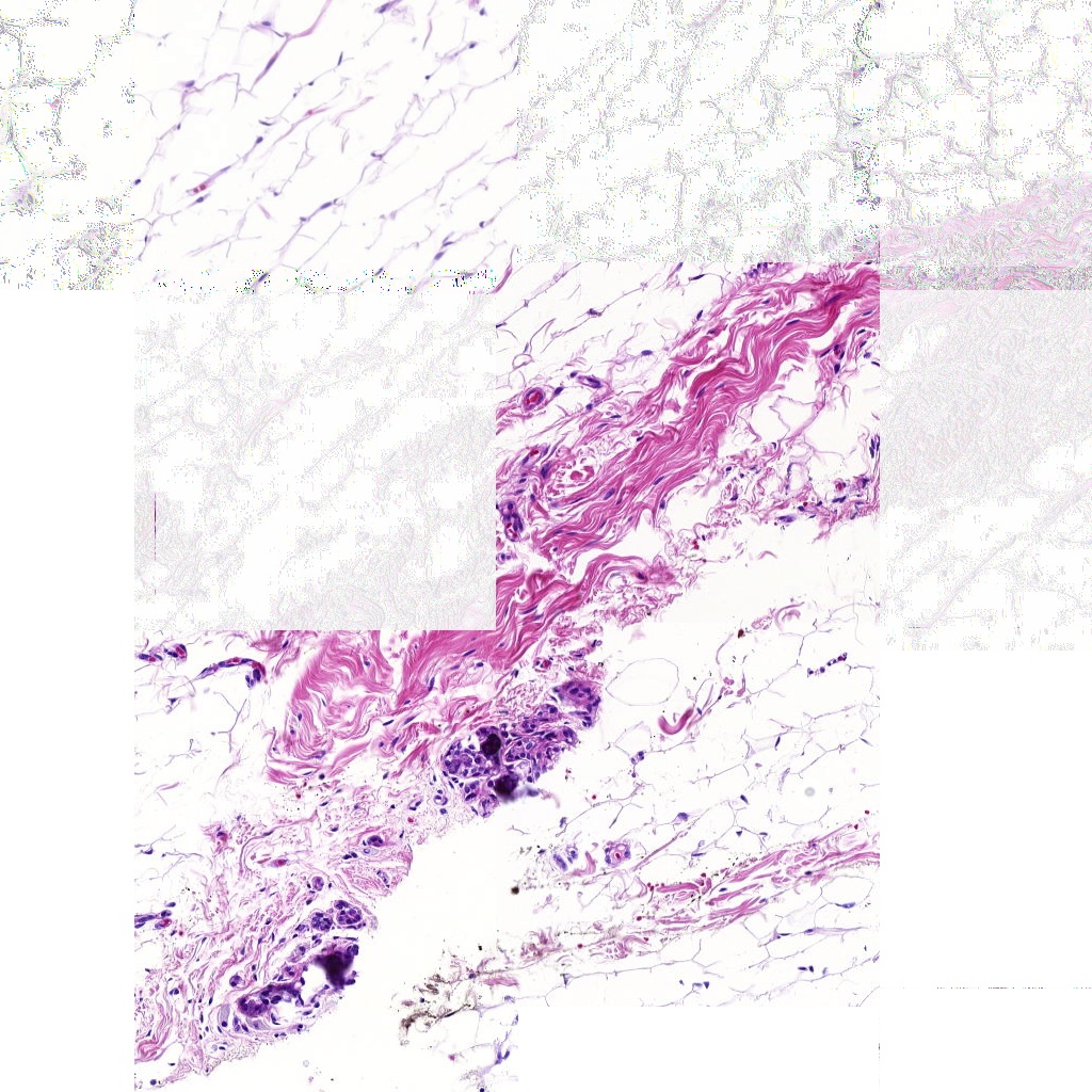 OpenSlide Error with Pixman Version 0.38 (Ubuntu 20.x) · Issue #133 · TissueImageAnalytics ...