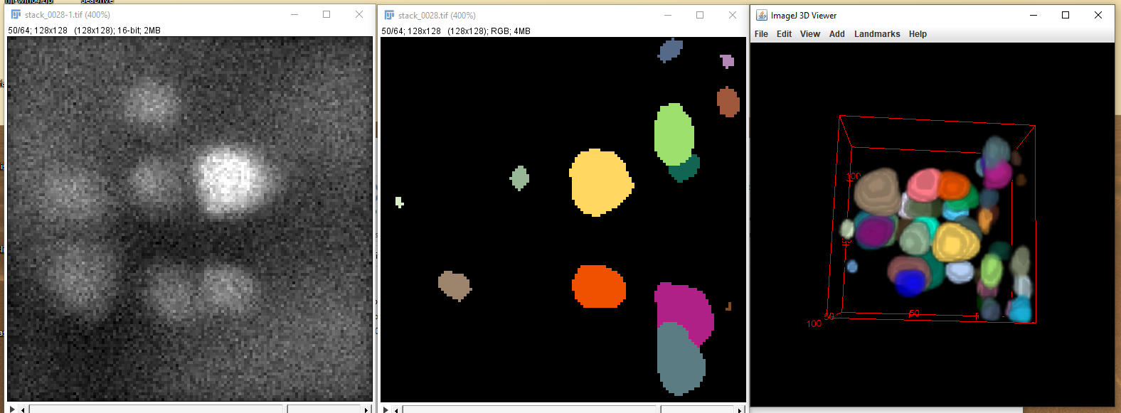 Image Border Ghost Object Artefact · Issue #116 · stardist/stardist · GitHub