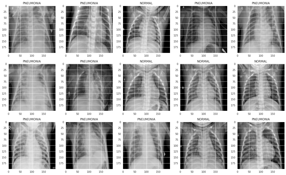 GitHub - 6cats1dog/Pediatric-Pneumonia-Image-Classification-with-Deep ...