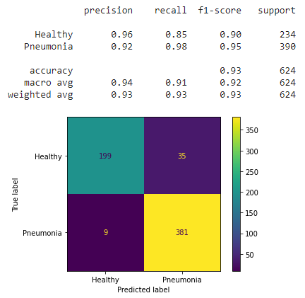 GitHub - NikitaBezukhov/Pneumonia_classifier_ResNet18