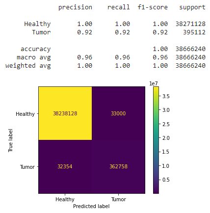 GitHub - NikitaBezukhov/Brain_tumor_segmentation_UnetPlusPlus
