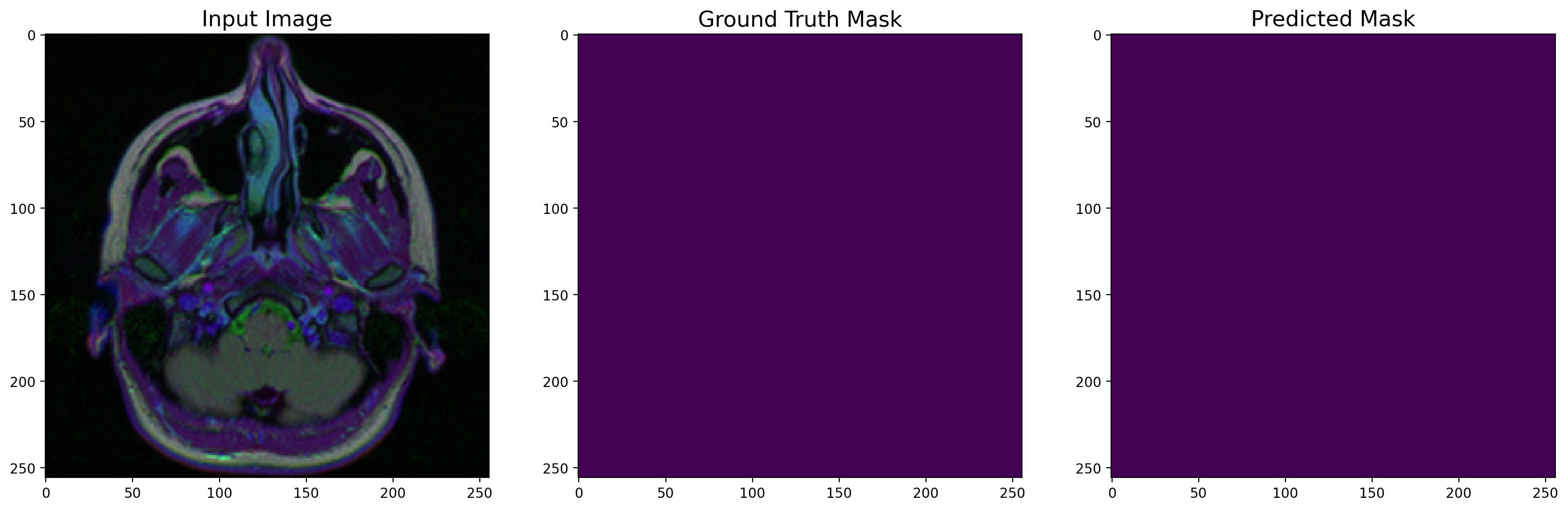 GitHub - NikitaBezukhov/Brain_tumor_segmentation_UnetPlusPlus