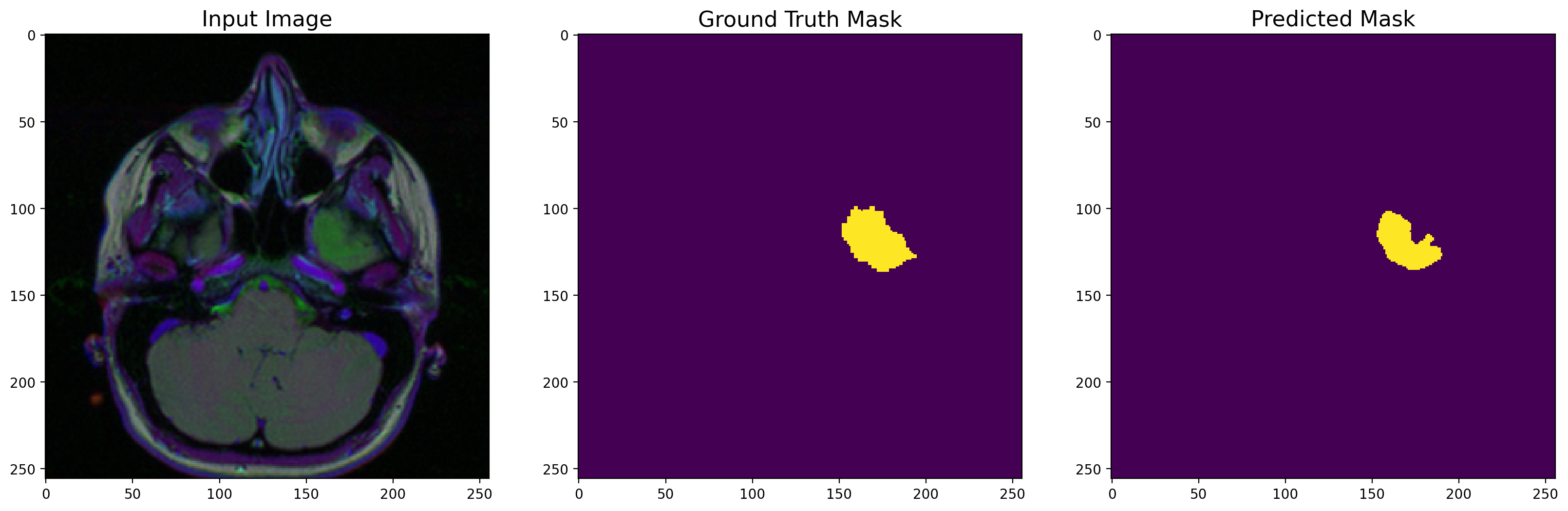 GitHub - NikitaBezukhov/Brain_tumor_segmentation_UnetPlusPlus