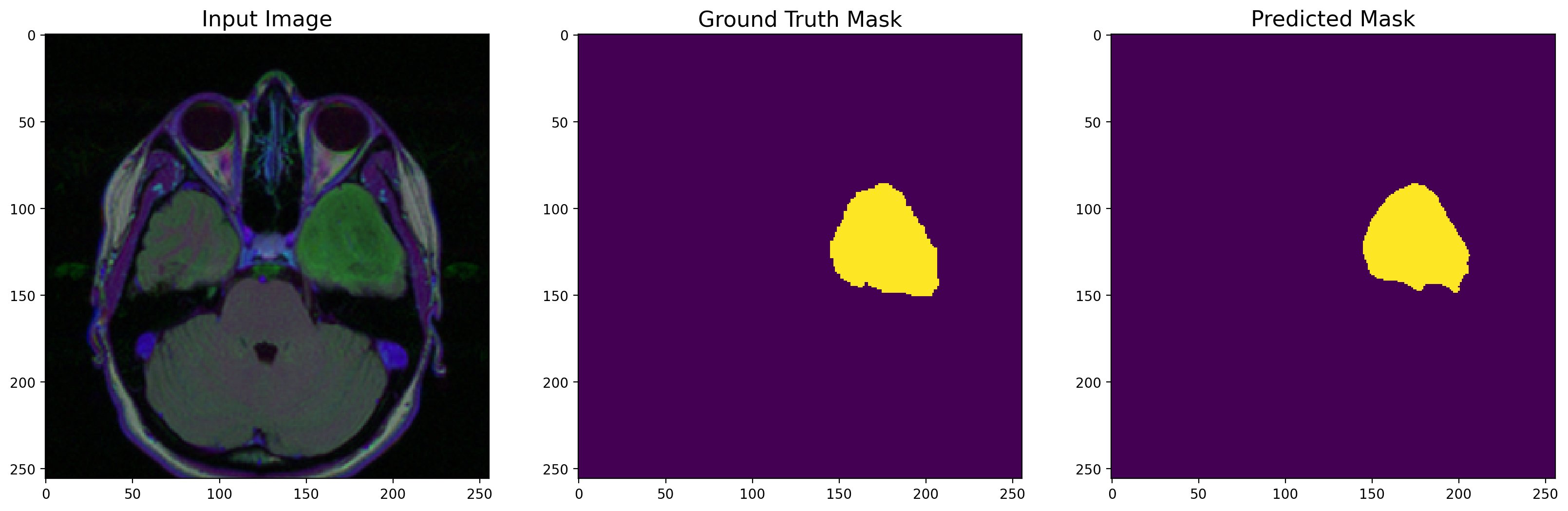 GitHub - NikitaBezukhov/Brain_tumor_segmentation_UnetPlusPlus