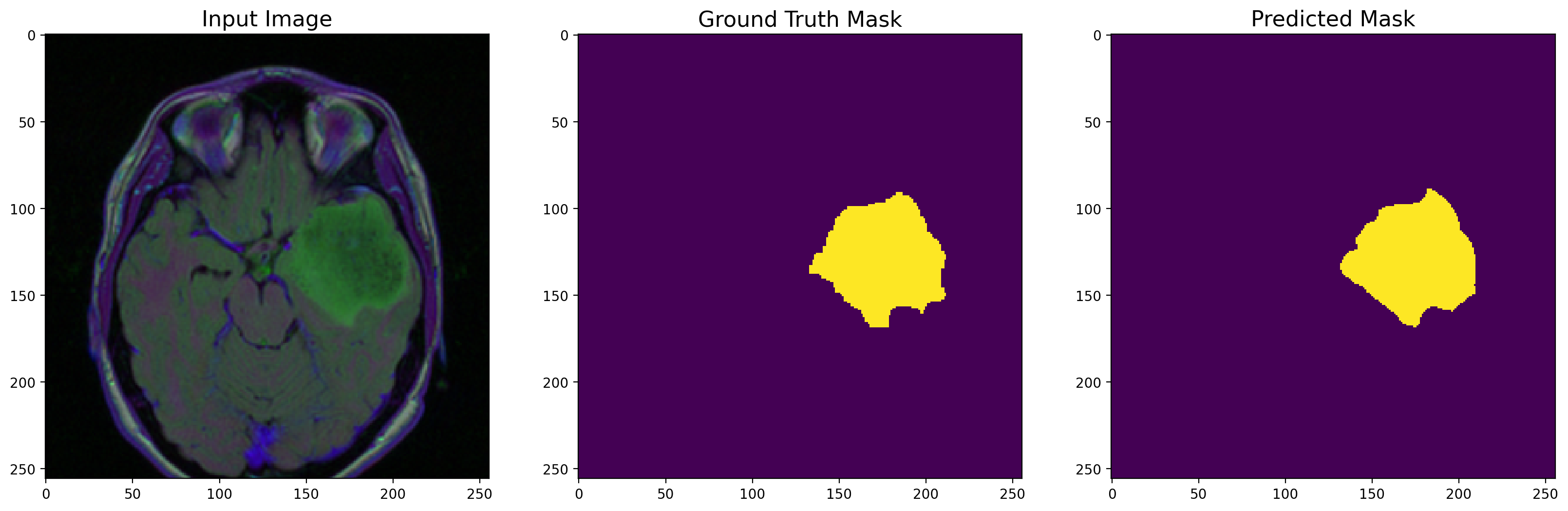 GitHub - NikitaBezukhov/Brain_tumor_segmentation_UnetPlusPlus