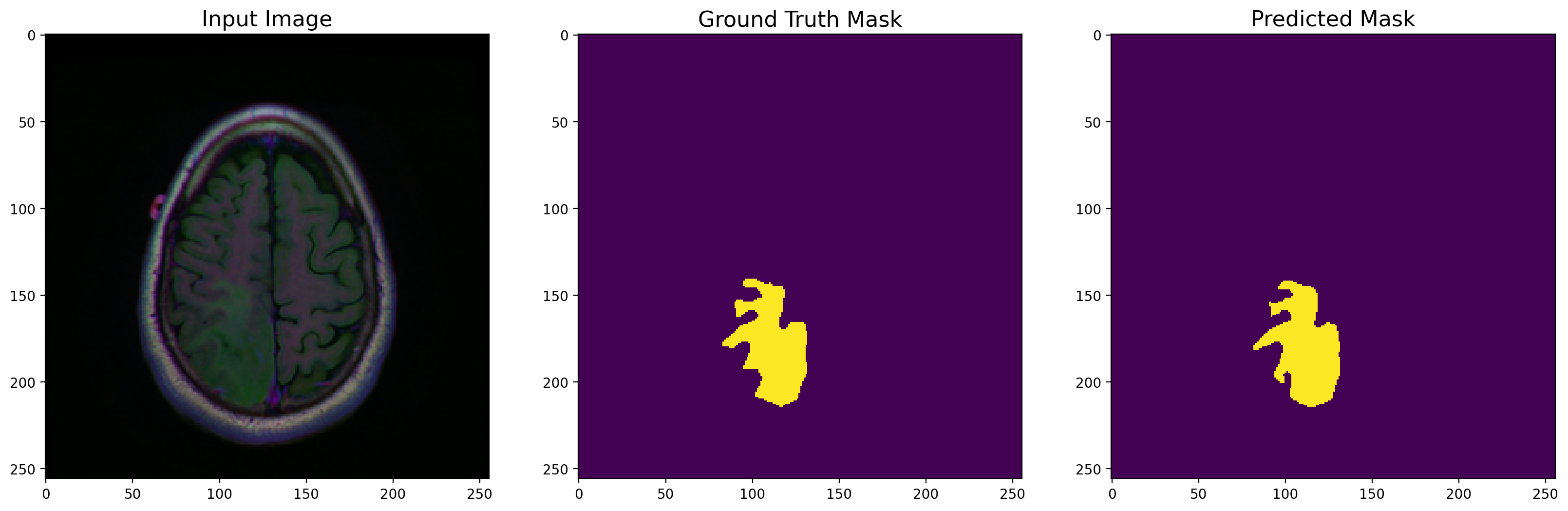 GitHub - NikitaBezukhov/Brain_tumor_segmentation_UnetPlusPlus