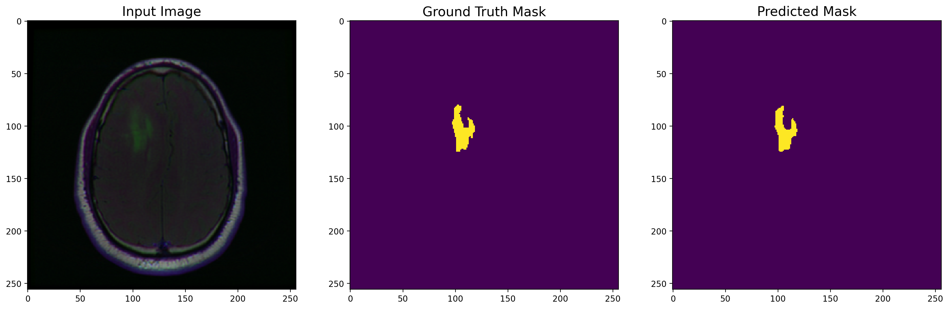 GitHub - NikitaBezukhov/Brain_tumor_segmentation_UnetPlusPlus