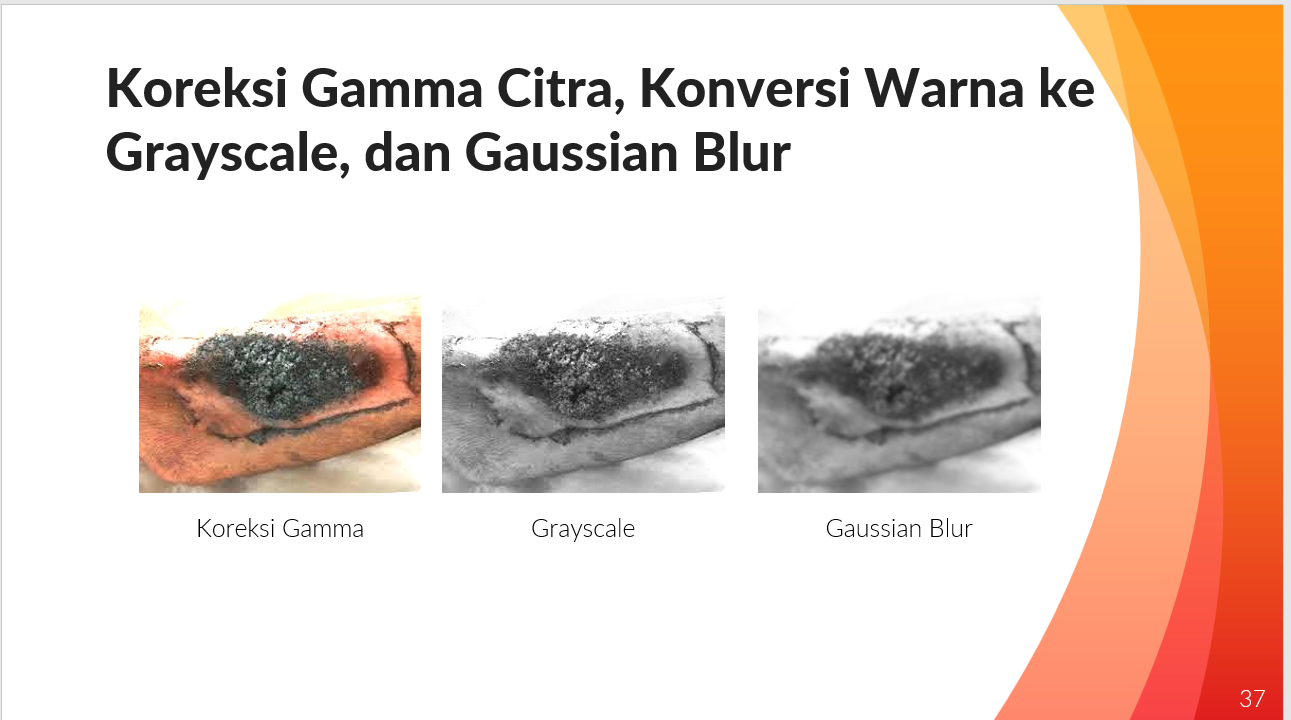 GitHub - alhusari2/Project-Segmentation-Skin-Burn: Segmentasi Citra pada Luka Bakar di Kulit ...