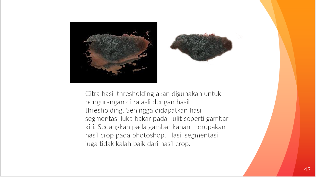 GitHub - alhusari2/Project-Segmentation-Skin-Burn: Segmentasi Citra ...