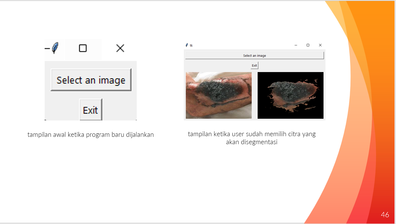 GitHub - alhusari2/Project-Segmentation-Skin-Burn: Segmentasi Citra pada Luka Bakar di Kulit ...