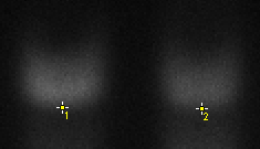 GitHub - JGanChong/ImageJ_Gel_Alignment_Macro: Aligns DNA/Protein Gels ...