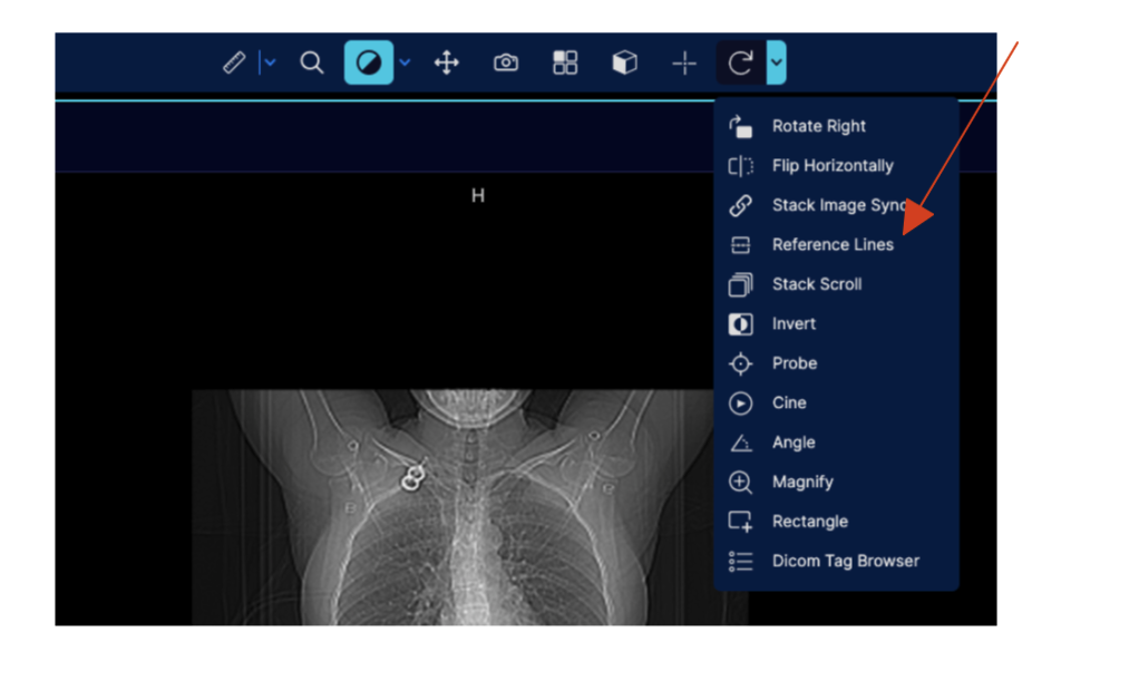 Ohif V3 Mpr Reference Lines · Issue 3030 · Ohif Viewers · Github