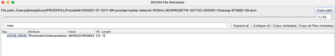 Search For Dicom Tag Browswer · Issue 3083 · Ohifviewers · Github 1721