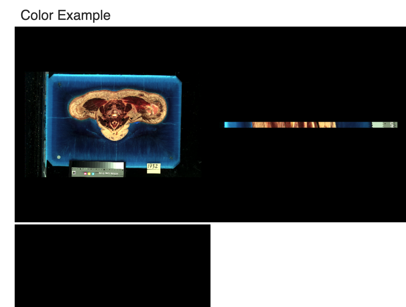 New color image volume example · Issue #361 · cornerstonejs/cornerstone3D · GitHub