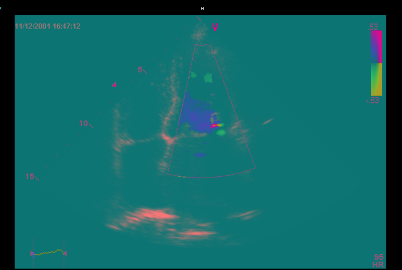 [Bug] Colorspace incorrect with color spectral doppler image · Issue ...